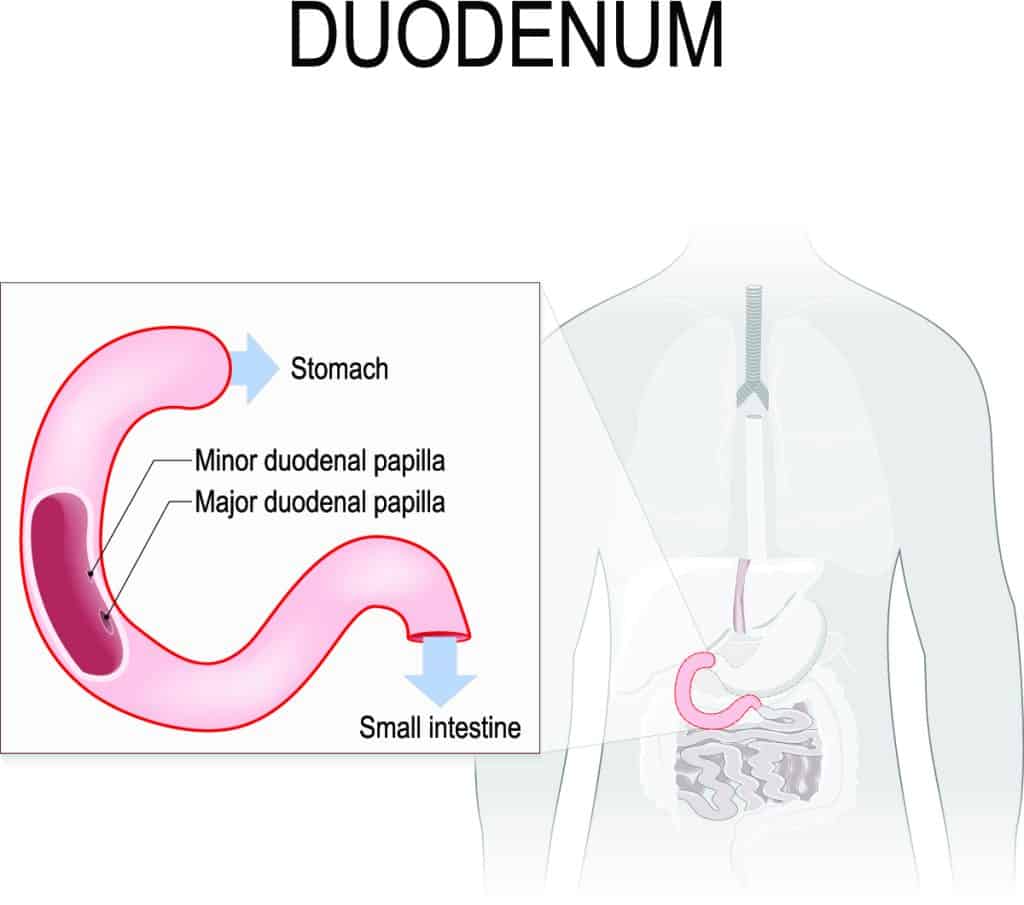 Duodenal Switch Procedure in Sydney - Severe Obesity Treatment