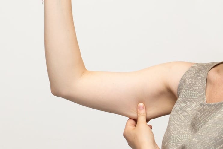 Arm Lift - Westlake OH - Raj Plastic Surgery