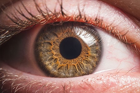 Corneal Disease Scottsdale AZ - Corneal Care Glendale