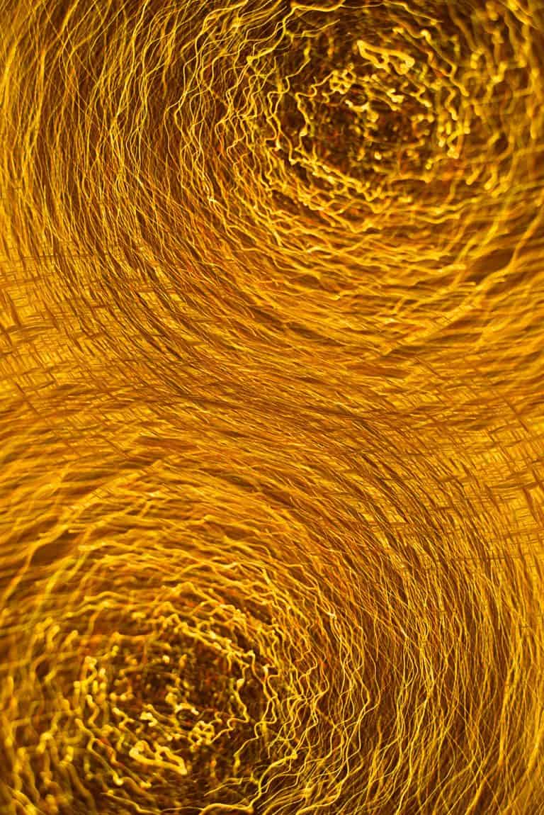 The Secret Life of Varicoceles | The Turek Clinic